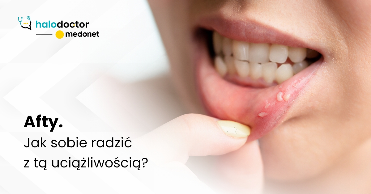 Afty. Jak sobie radzić z tą uciążliwością