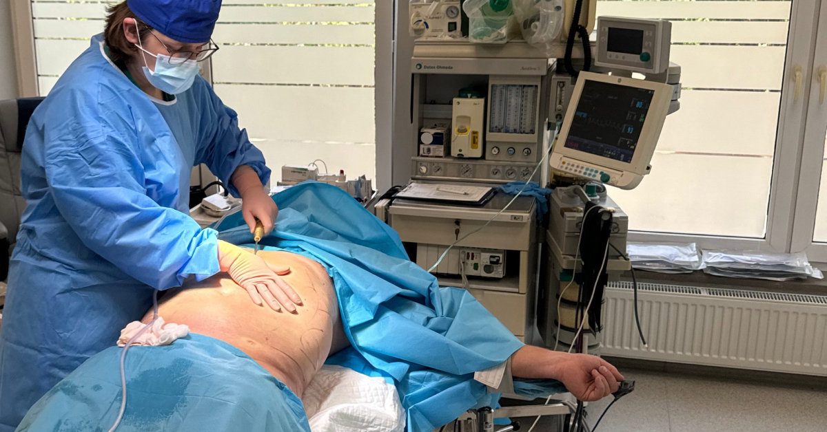 Liposukcja brzucha i talii. Najlepsze połączenie w modelowaniu sylwetki