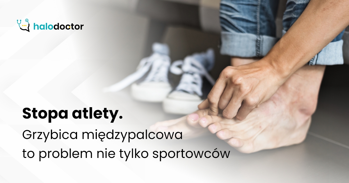 Stopa atlety. Grzybica międzypalcowa to problem nie tylko sportowców