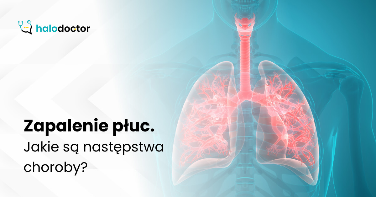 Zapalenie płuc – przyczyny, przebieg choroby i powikłania ⚕️