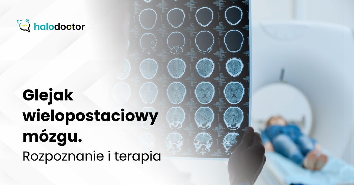 Glejak wielopostaciowy mózgu. Rozpoznanie i terapia
