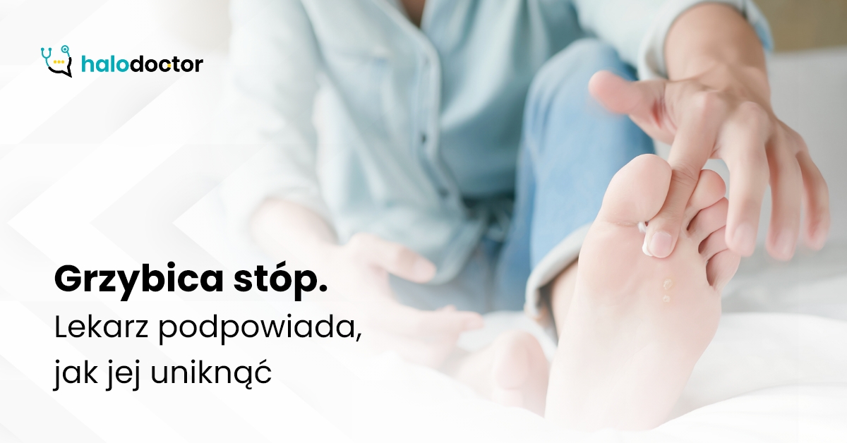 Grzybica stóp. Lekarz podpowiada, jak jej uniknąć